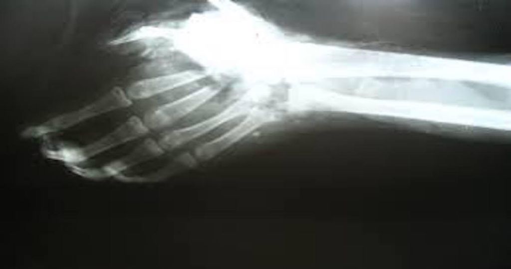 12 Amazing Facts About Left Handed People That You Didn't Know About ...